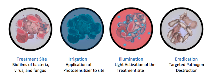 COMMON TREATMENTS WITH LASER – Moses