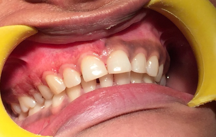 COMMON TREATMENTS WITH LASER – Moses